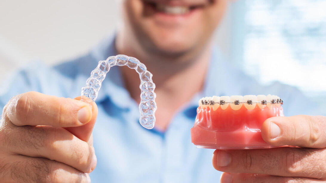 Invisalign VS Metal Braces | Sydney Park Dental